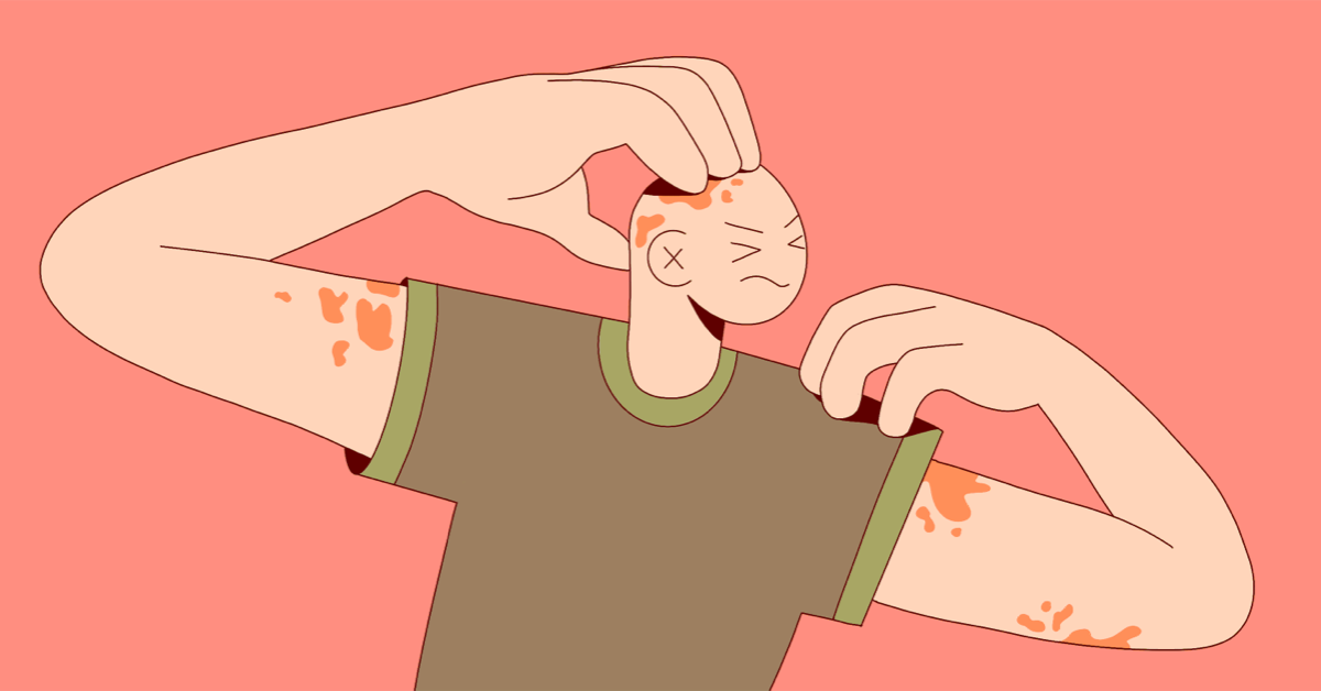 Hidradenitis Suppurativa Symptoms: Itching