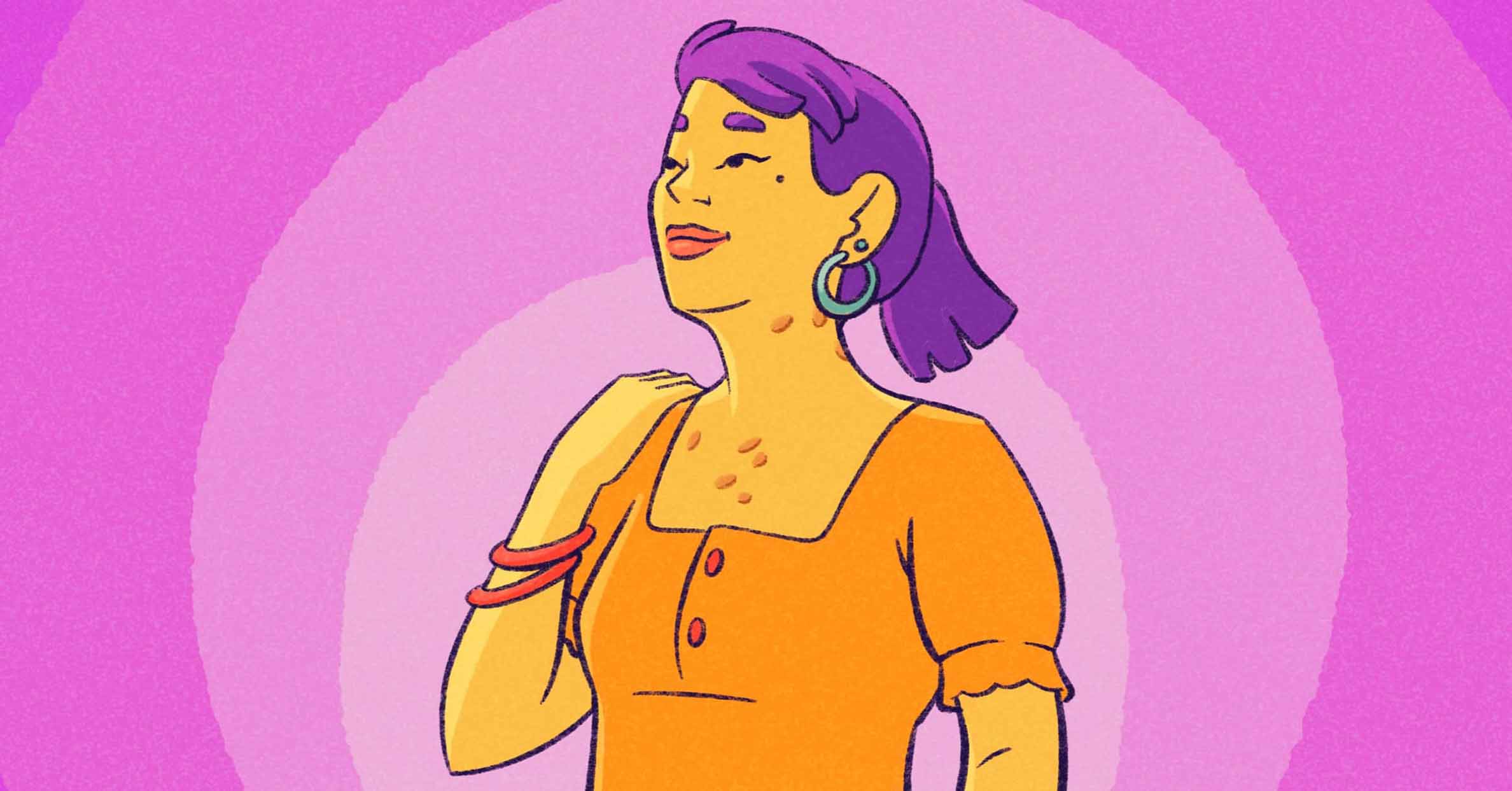 Hidradenitis Suppurativa Flares in Uncommon Places